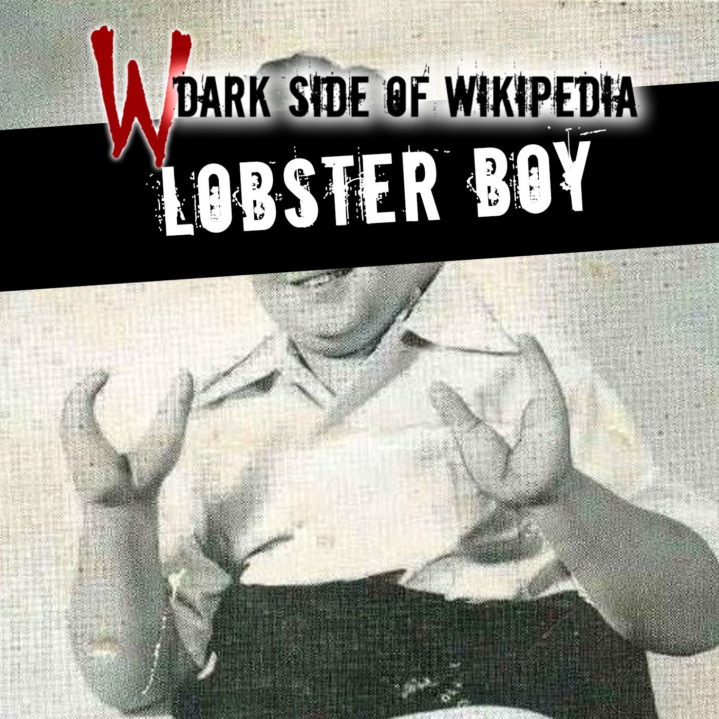 Grady Stiles Grady Franklin "Lobster Boy" Stiles, Jr., Age 55
